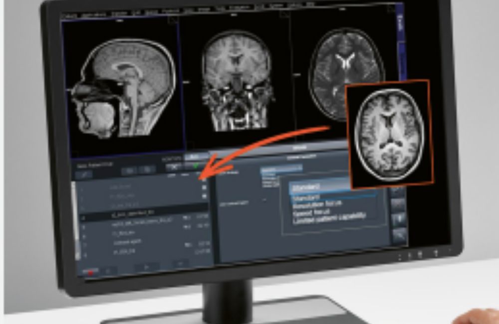 Charlestown welcomes state-of-the-art MRI technology | Newcastle Weekly